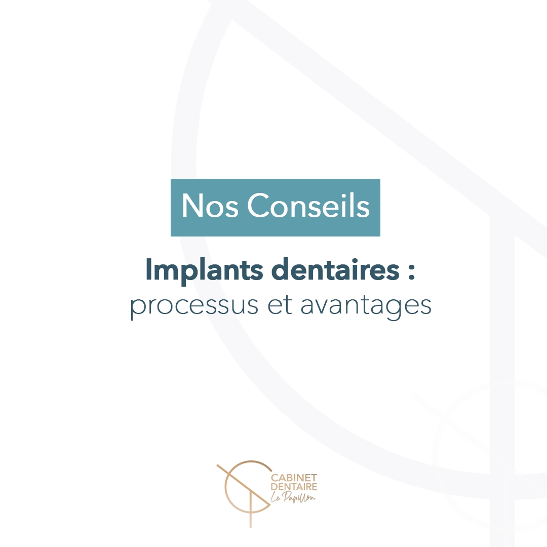 Implants dentaires : processus et avantages - Cabinet Dentaire Le Papillon